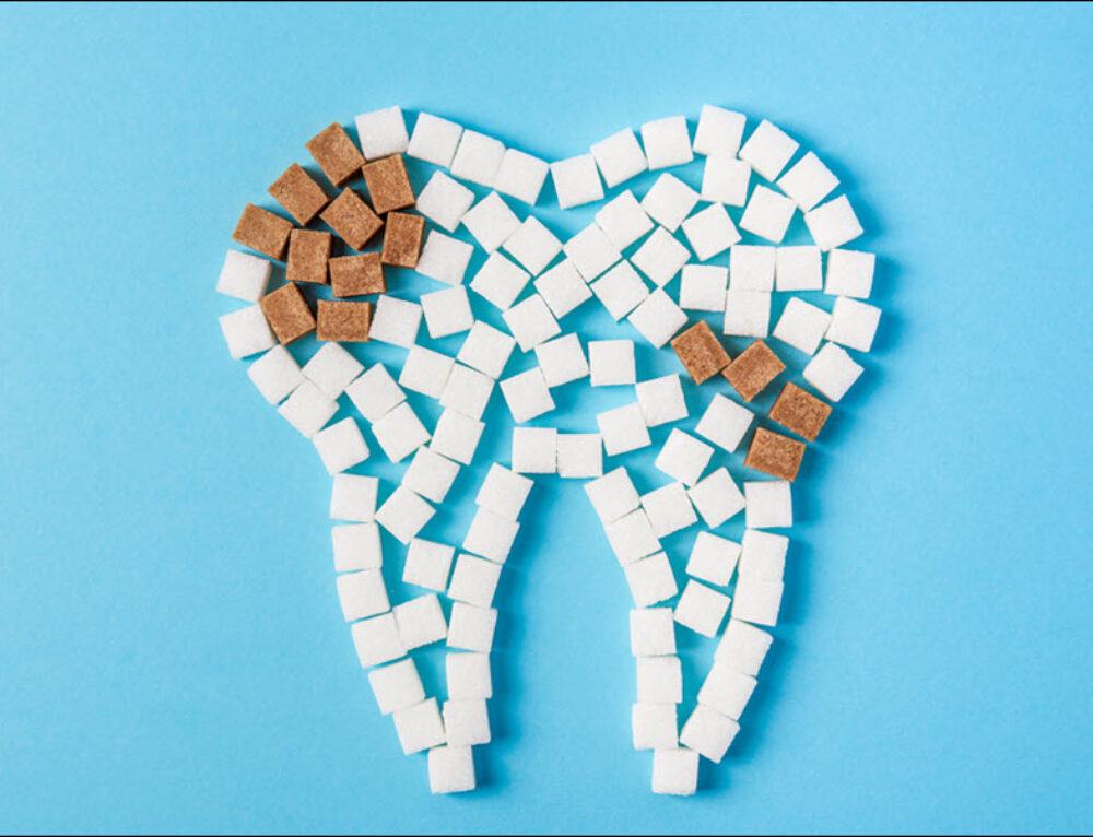 Intraoral Photos: Enhancing Diagnosis and Treatment - Premier Dental of ...